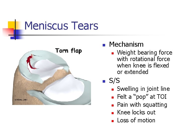 Signs and Symptoms of Knee Injuries Introduction Bell