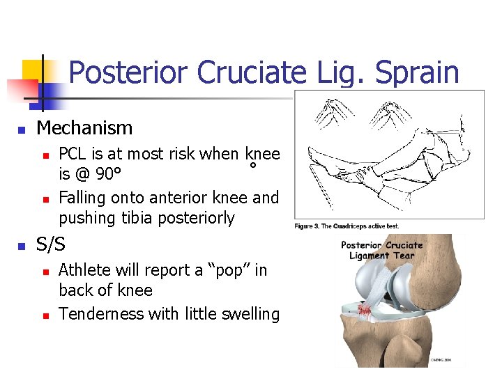 Signs and Symptoms of Knee Injuries Introduction Bell