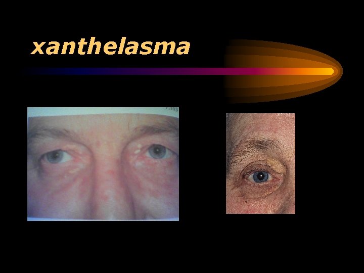 Disorders of Lipid Metabolism By Dr Nermin Ahmed