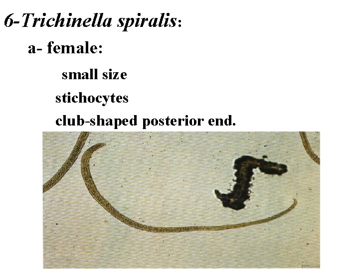 Lab 5 Strongyloides stercoralis Threadworm Trichinella spiralis The