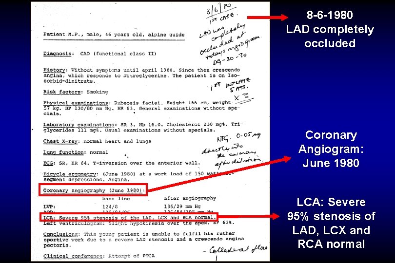 A BRIEF HISTORY OF THE INTERVENTIONAL TREATMENT OF