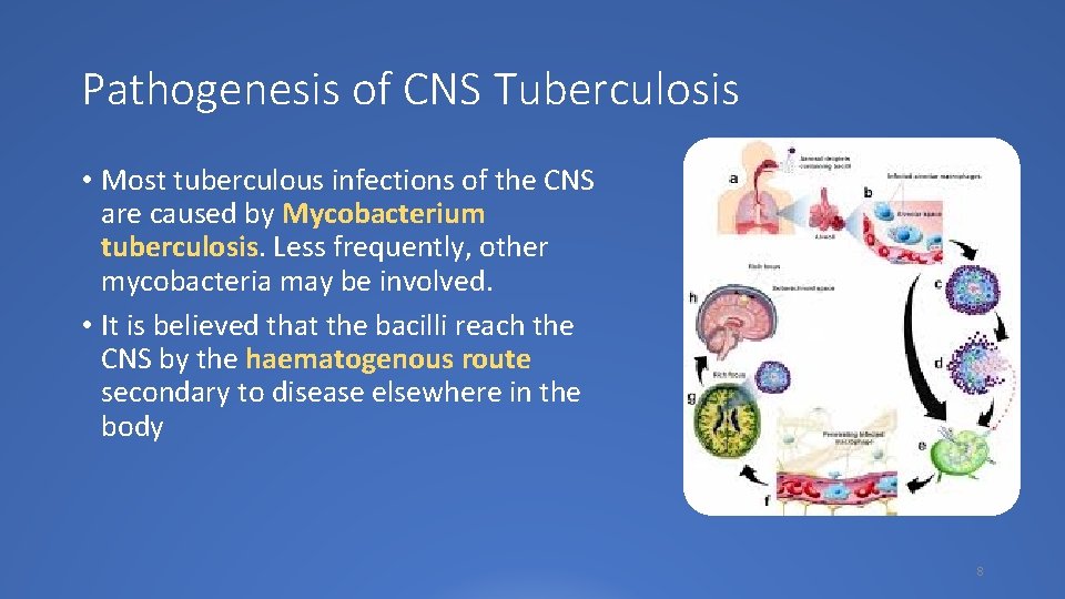 Manifestasi dan Tatalaksana TB pada Sistem Saraf Rivan