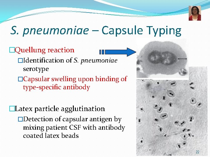 Lower Respiratory Tract Infections Part 2 Bacterial infections