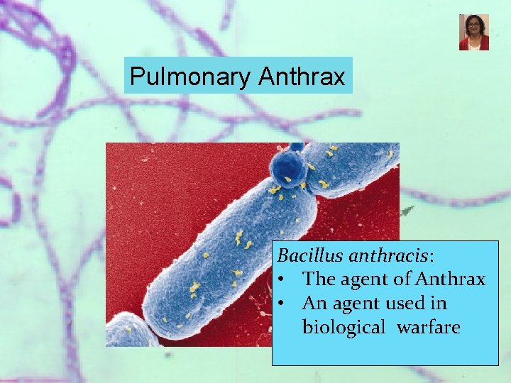 Lower Respiratory Tract Infections Part 2 Bacterial infections