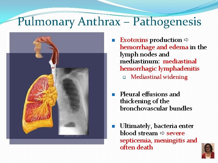 Lower Respiratory Tract Infections Part 2 Bacterial infections