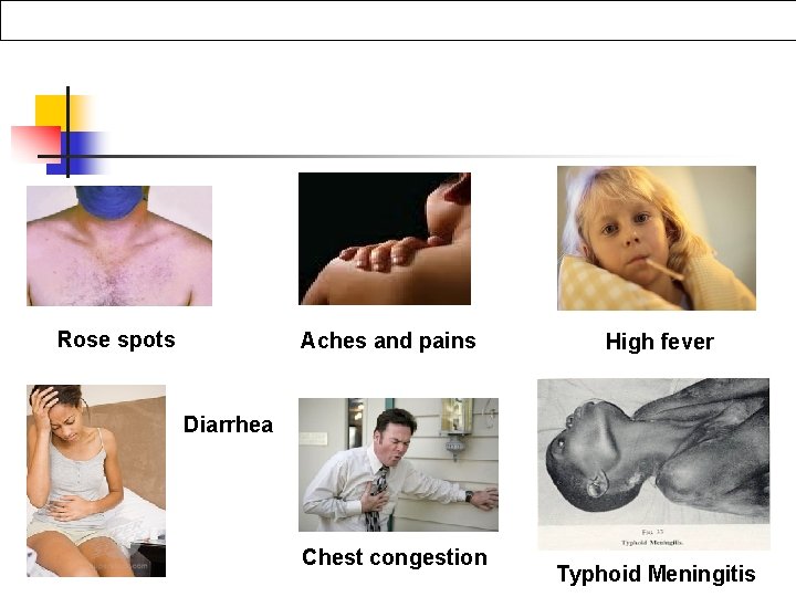 Microbiology labratory Typhoid fever Widal test Infectious Disease