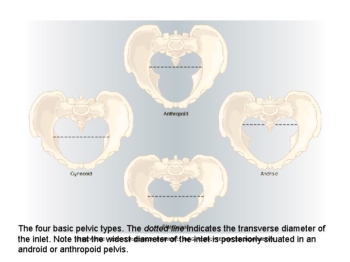 Manual removal of the placenta The abdominal hand