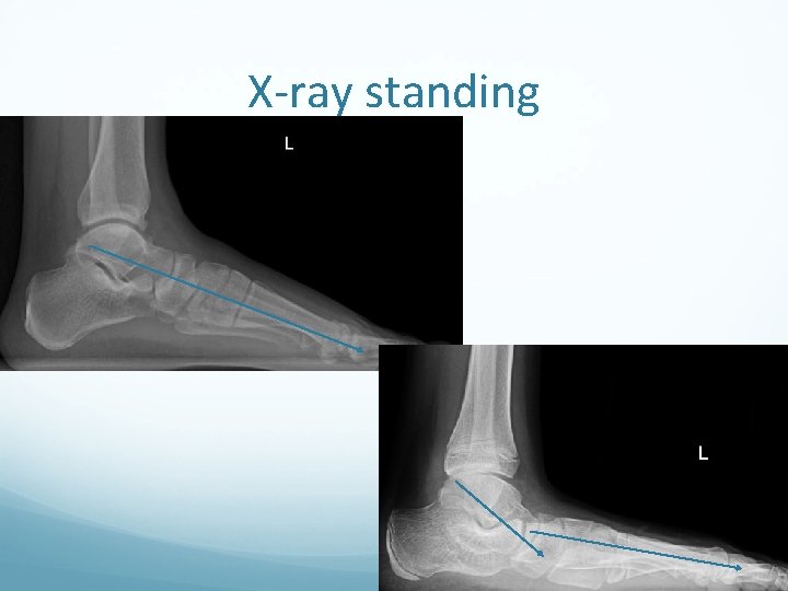 Common Foot and Ankle Disorders Abdulaziz Almaawi MD