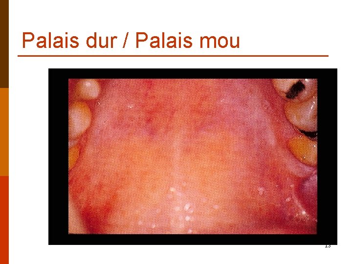 Cours 2 Structures normales de la cavit buccale