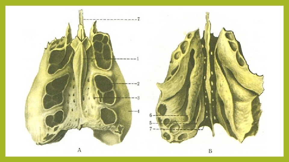 11 KOSTI VISCEROKRANIJA DETALJI MORFOLOGIJE I TOPOGRAFIJA Medicinska