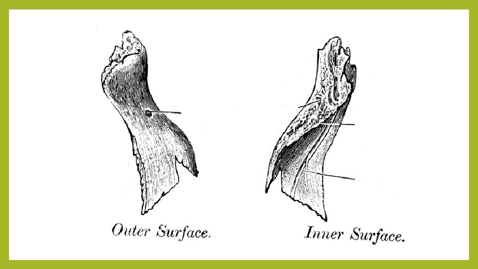 11 KOSTI VISCEROKRANIJA DETALJI MORFOLOGIJE I TOPOGRAFIJA Medicinska