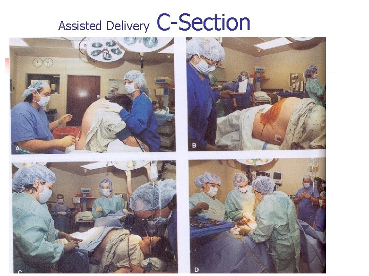 BirthRelated Procedures Chapter 20 n Induction of labor