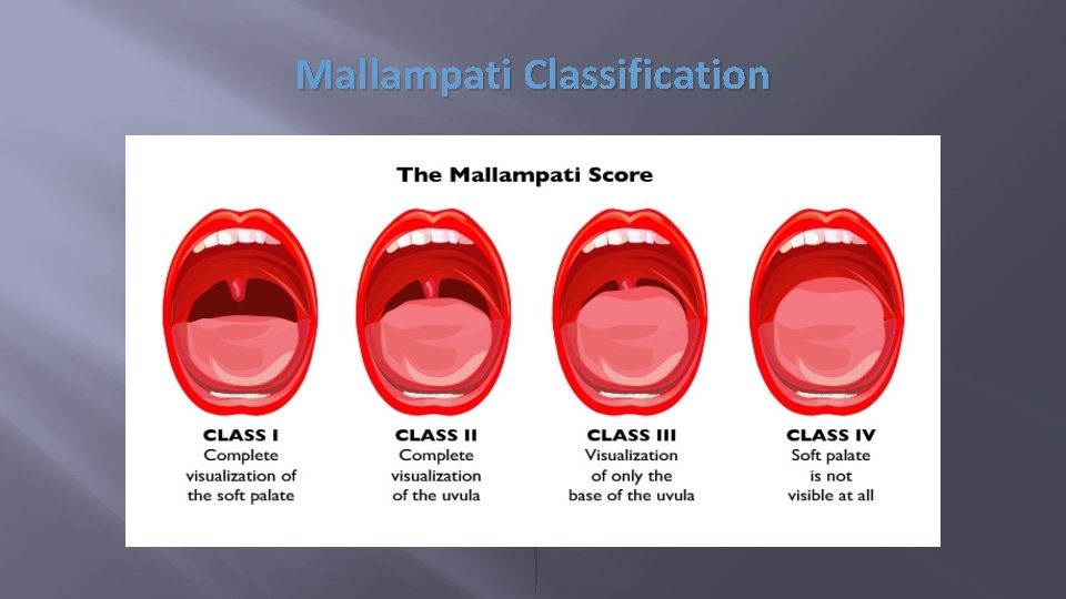 ANESTHESIA CONSIDERATIONS INTRAOPERATIVE NURSING ROLES Jeff Worrell Ltc