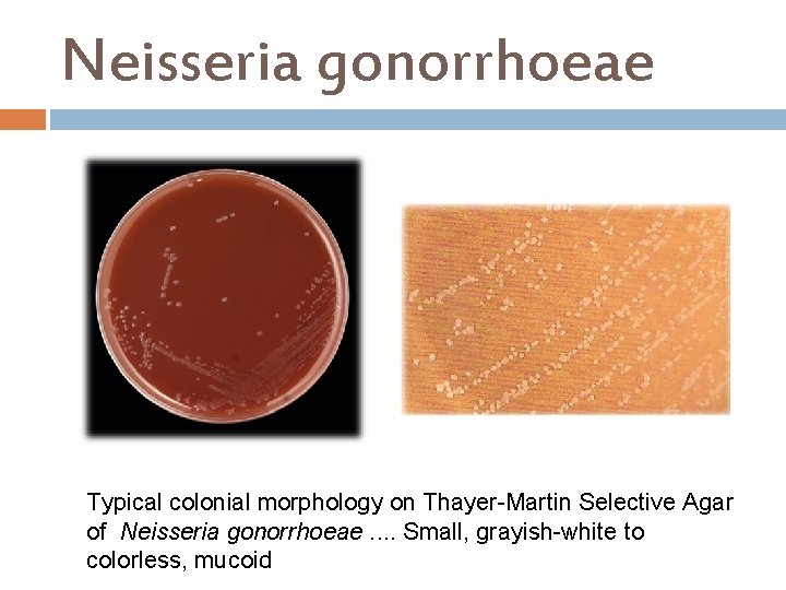 Thayer Martin agar Chocolate agar has been modified