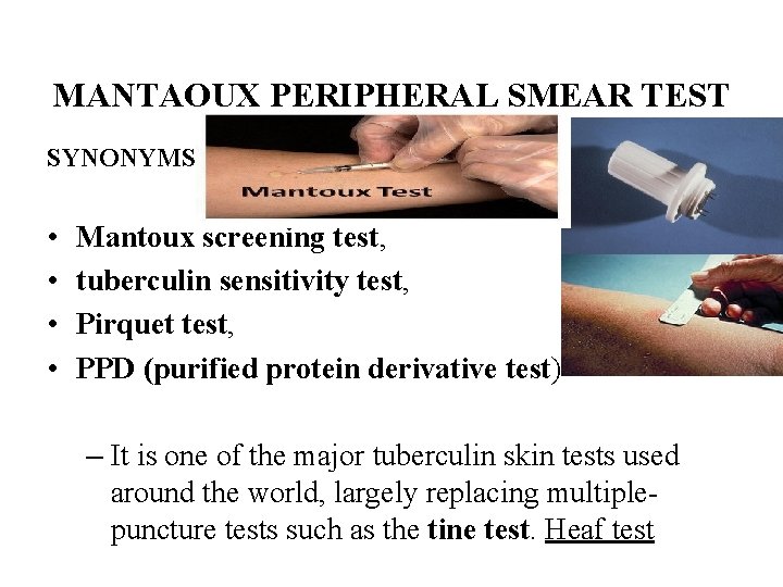 Diagnostic tests Schicks Test Elisa test Western Blot