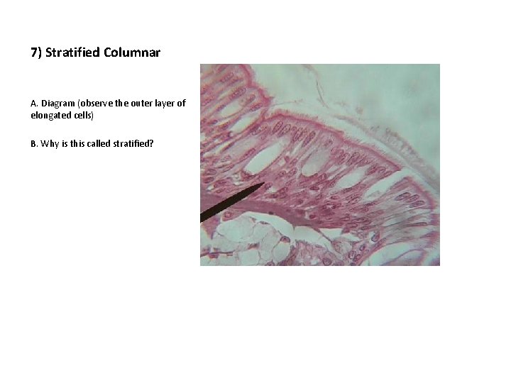 Epithelial Tissue Lab Draw the diagram and answer
