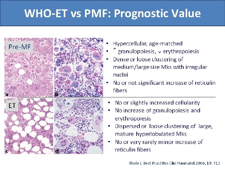 Emerging JAK Inhibitors in Myelofibrosis Determining the Right