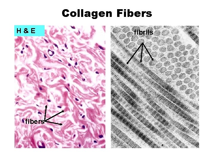 helium Connective T Cells closely aggregated tight by