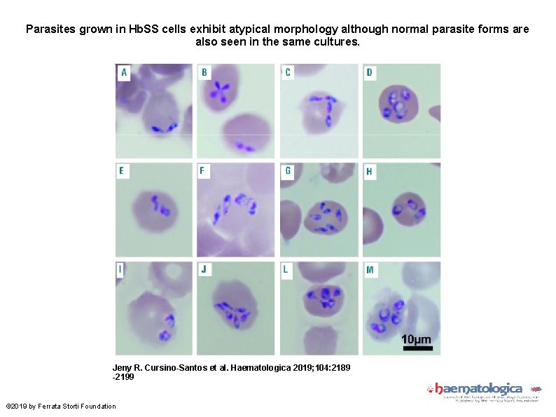Altered Parasite Lifecycle Processes Characterize Babesia Divergens
