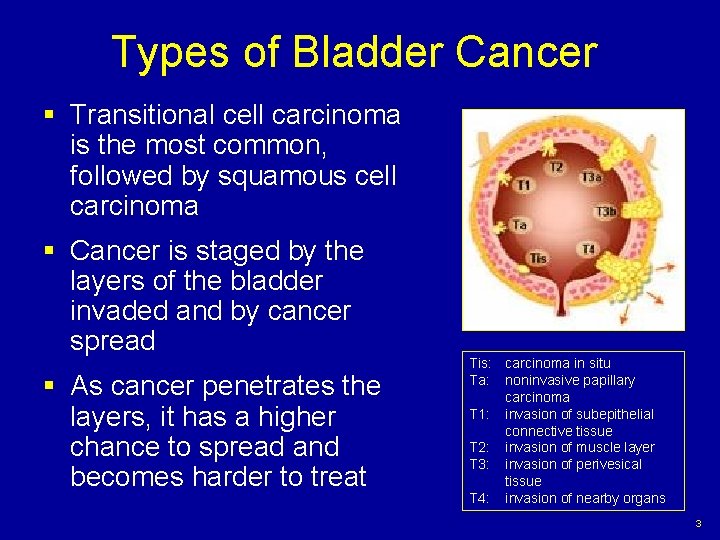 Urinary Risk Factors for Bladder Cancer ICD9 CM