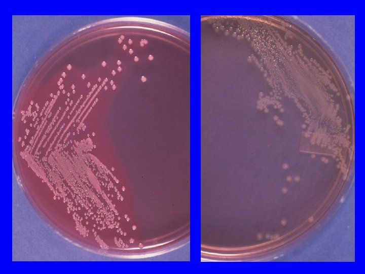 Stool Cultures for Water Samples Julie A Ribes