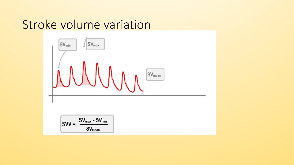 Goal directed fluid therapy Dr S Parthasarathy MD
