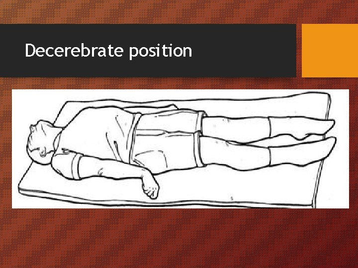 MANAGEMENT OF UNCONSCIOUS PATIENT DR MANSOOR AHMAD KHAN