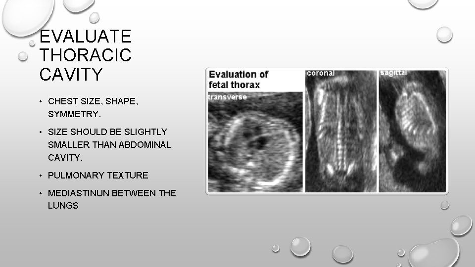 FETAL THORAX EMBRYOLOG Y THE SURVIVAL OF THE