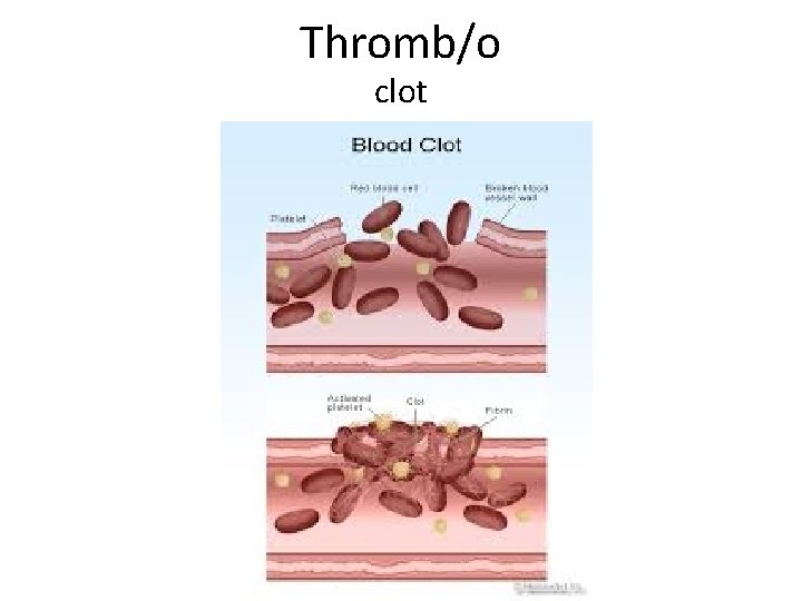 The blood lymphatic system Immune system Medical Terminology