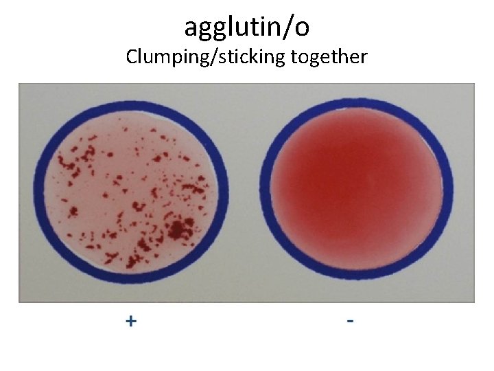 The blood lymphatic system Immune system Medical Terminology