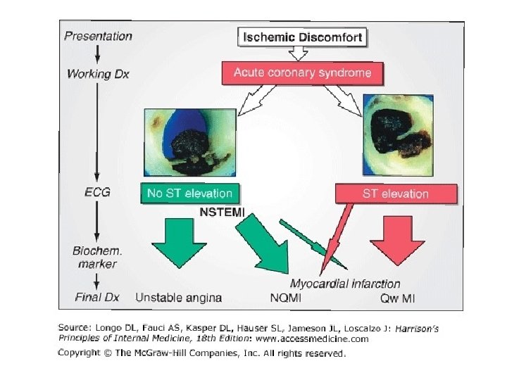 STEMI Management Heidarimoghaddam MD 2020 Epidemiology of STEMI