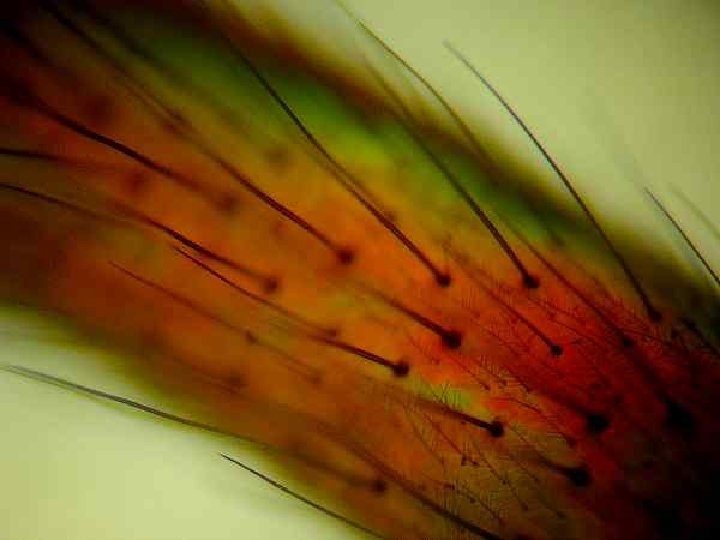 Phylum Arthropoda General Characteristics Arthropod jointed foot Exhibit