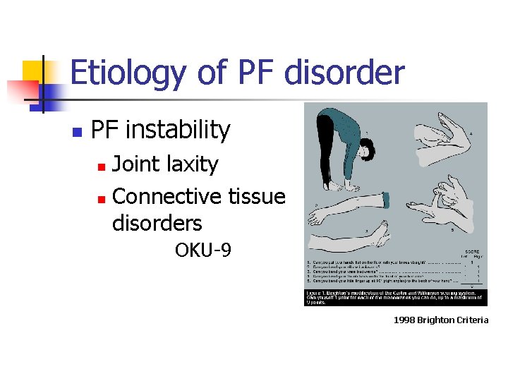 Classification of patella morphology by Wiberg and Baumgartl