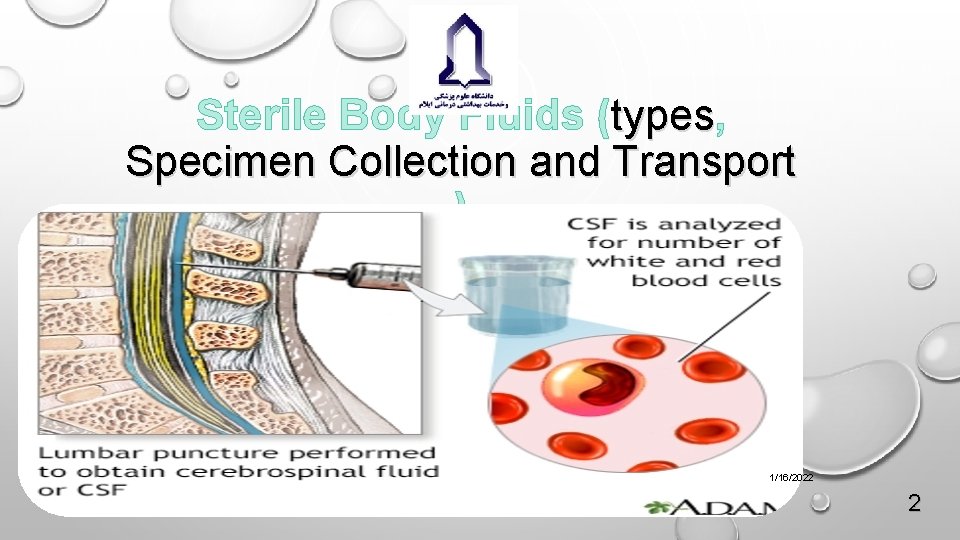 1162022 1 Sterile Body Fluids types types Specimen
