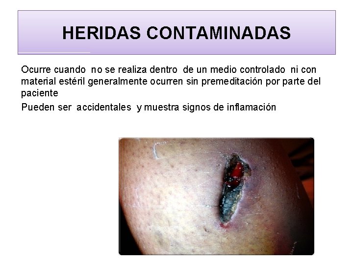 INTEGRIDAD CUTNEA Y CUIDADO DE LAS HERIDAS OBJETIVOS