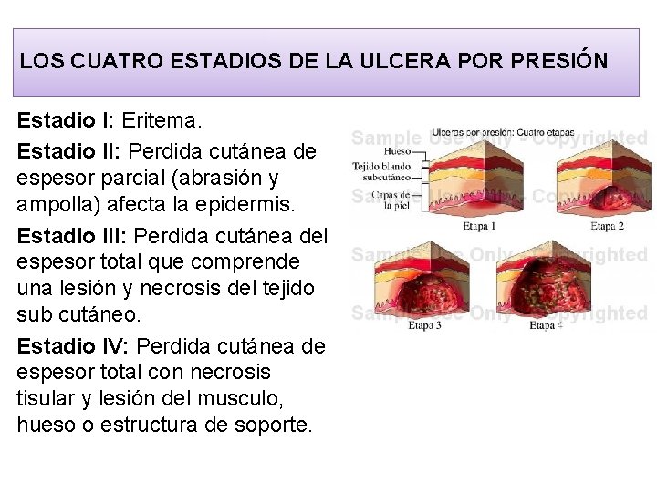 INTEGRIDAD CUTNEA Y CUIDADO DE LAS HERIDAS OBJETIVOS