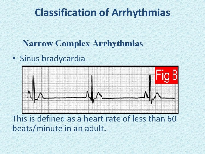 ECG Monitoring By Dr Ahmed Mostafa Assist Prof