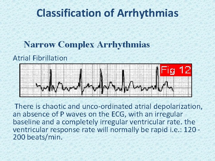 ECG Monitoring By Dr Ahmed Mostafa Assist Prof