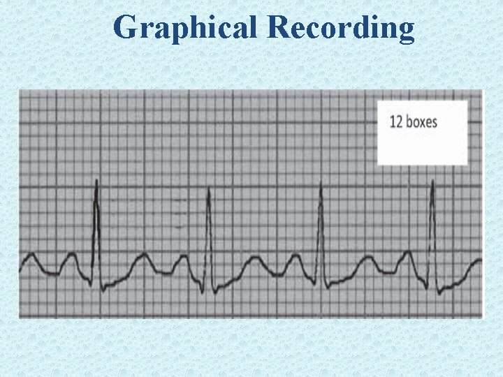 ECG Monitoring By Dr Ahmed Mostafa Assist Prof