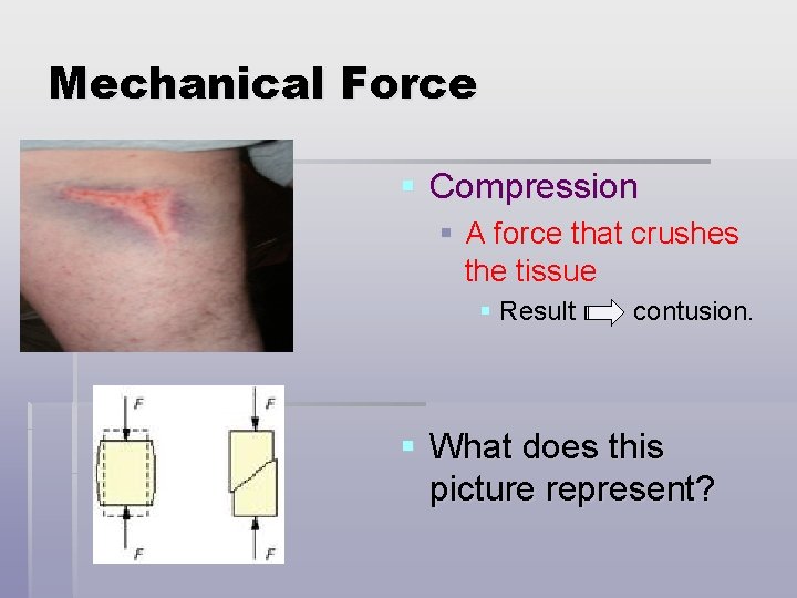 Evaluation Assessment Mechanical Forces Muscle Injuries Bell Work