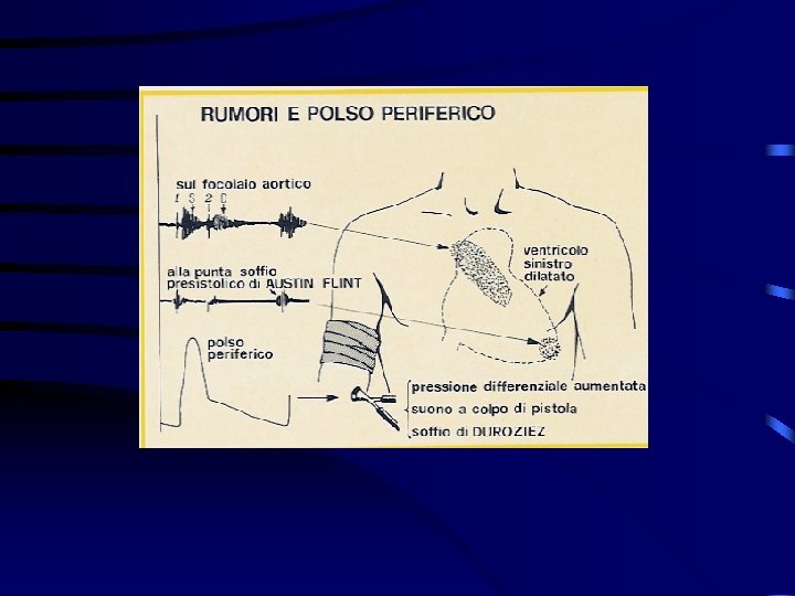 ESAME OBIETTIVO DEL CUORE ISPEZIONE PALPAZIONE PERCUSSIONE AUSCULTAZIONE
