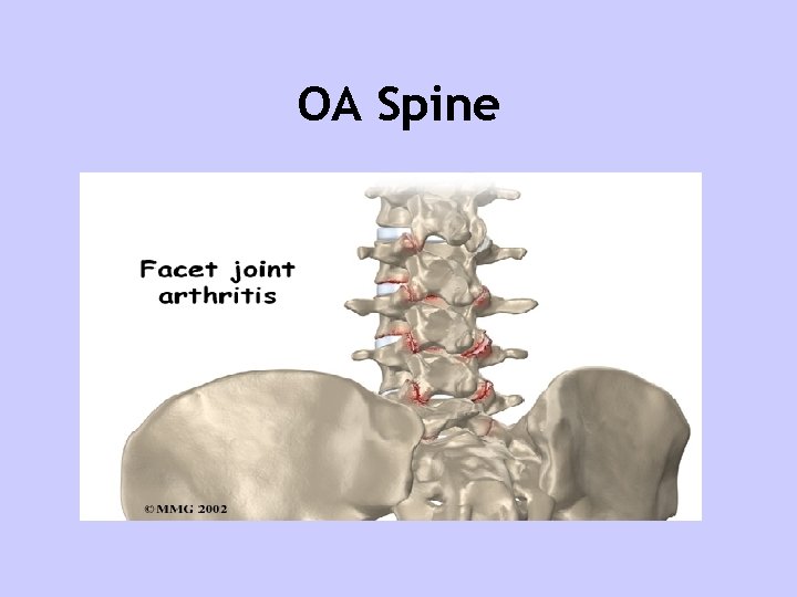 The Lumbar Spine Introduction Prevalance Diagnosis of lumbar