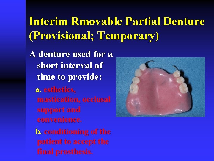 Introduction to Removable Partial Prosthodontics Rola M Shadid