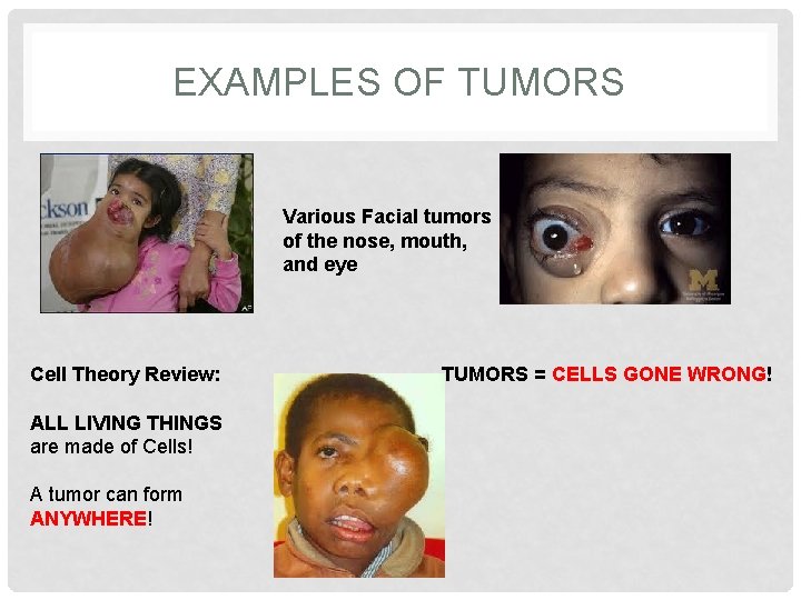 CANCER AND MITOSIS CASE STUDY BIOLOGY OBJECTIVES SC