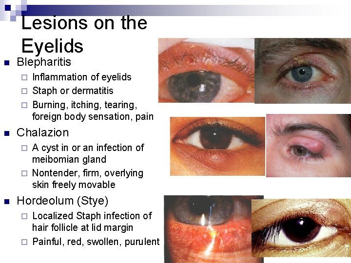 Assessment of Eyes and Ears Eye Anatomy Why