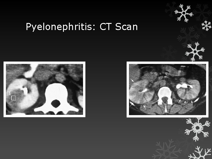Approach to Patient with UTI Mohammed Rabeh Aldhaheri