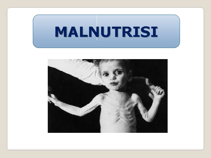 SISTEM ENDOKRIN PATOFISIOLOGI DAN TERMINOLOGI MEDIK MALNUTRISI DAN