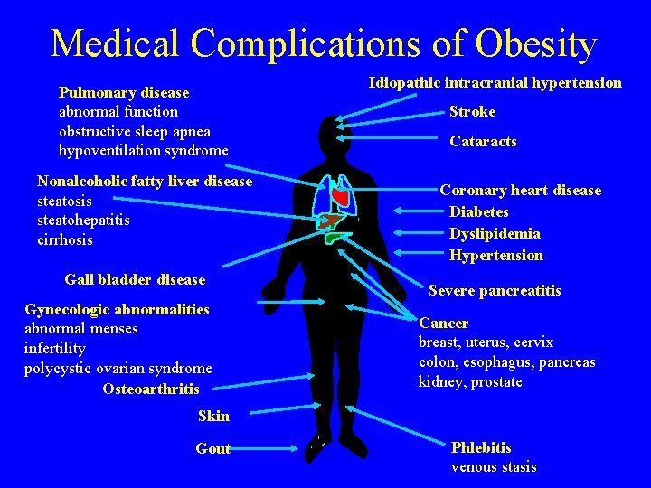 The ObesityDiabetes Epidemic Adiposopathy Obesity The New Disease