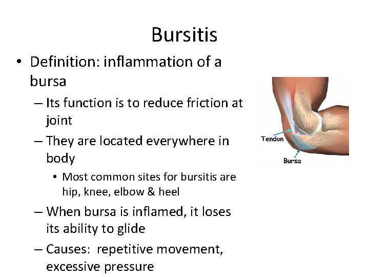Joint Injuries Sprain General Info Most common injury