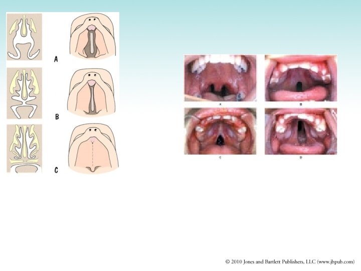 Chapter 23 The Gastrointestinal Tract Learning Objectives 1